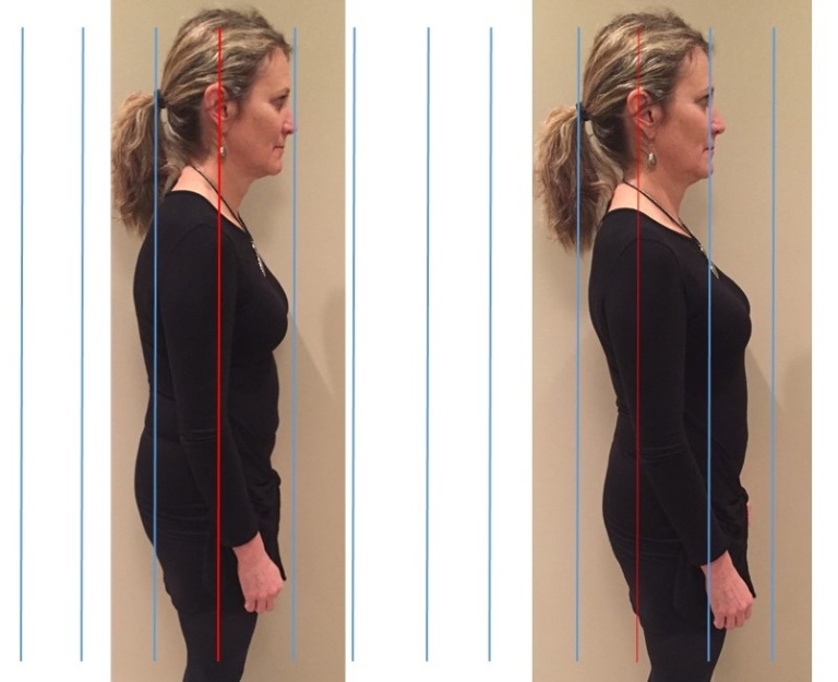 Anderson Ergonomics Consulting Inc. - Does Your Posture Stand Up to the ...